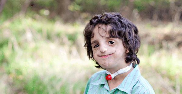 This Man Born With Facial Deformities Is an Inspiration to Us All ...